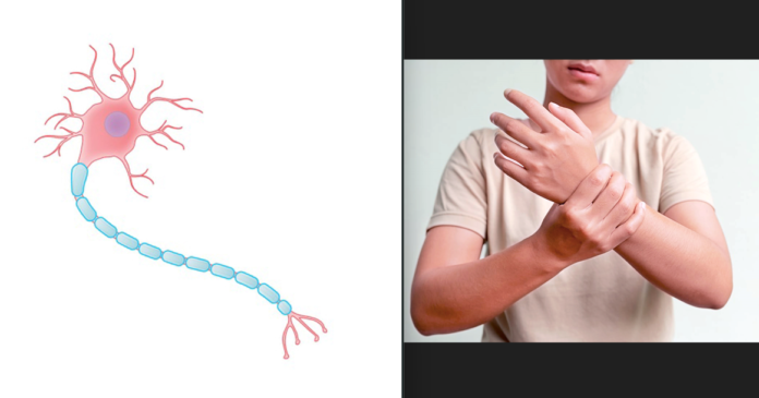 Decoding Guillain-Barré Syndrome: How CSF Analysis Aids in Early ...